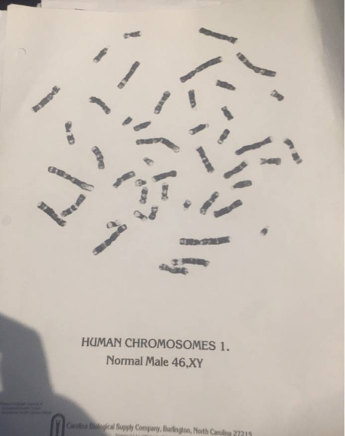(Solved) - HUMAN CHROMOSOMES 1. Normal Male 46.XY Carolina Biological ...